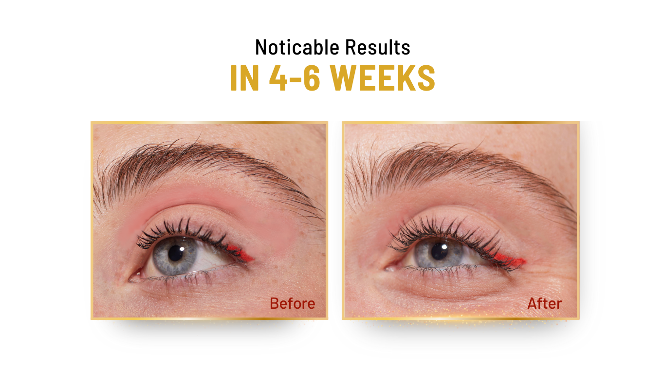 The Eyelash Growth Cycle: A Comprehensive Guide